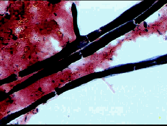 Filamentous Identification